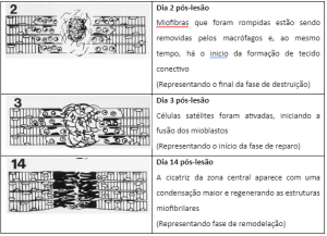 Lesões musculares: da avaliação ao tratamento - E-fisio